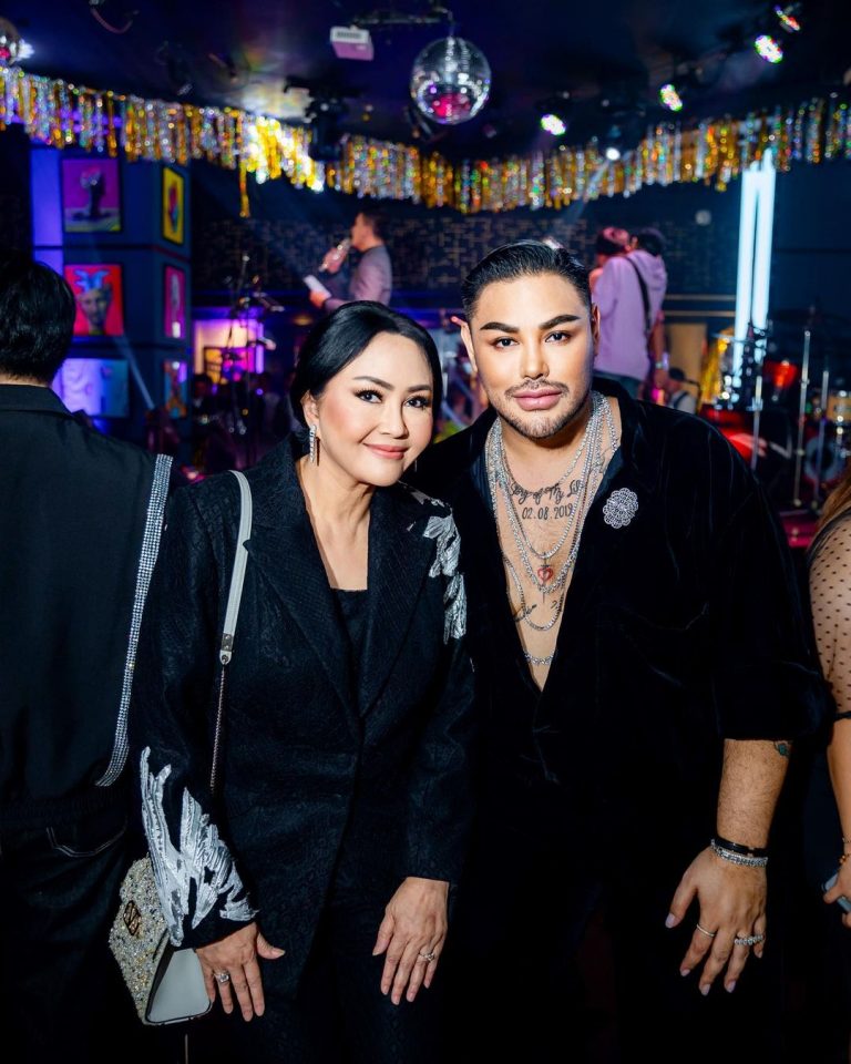 10 Potret Wajah Baru Ivan Gunawan Usai Operasi Plastik di Turki